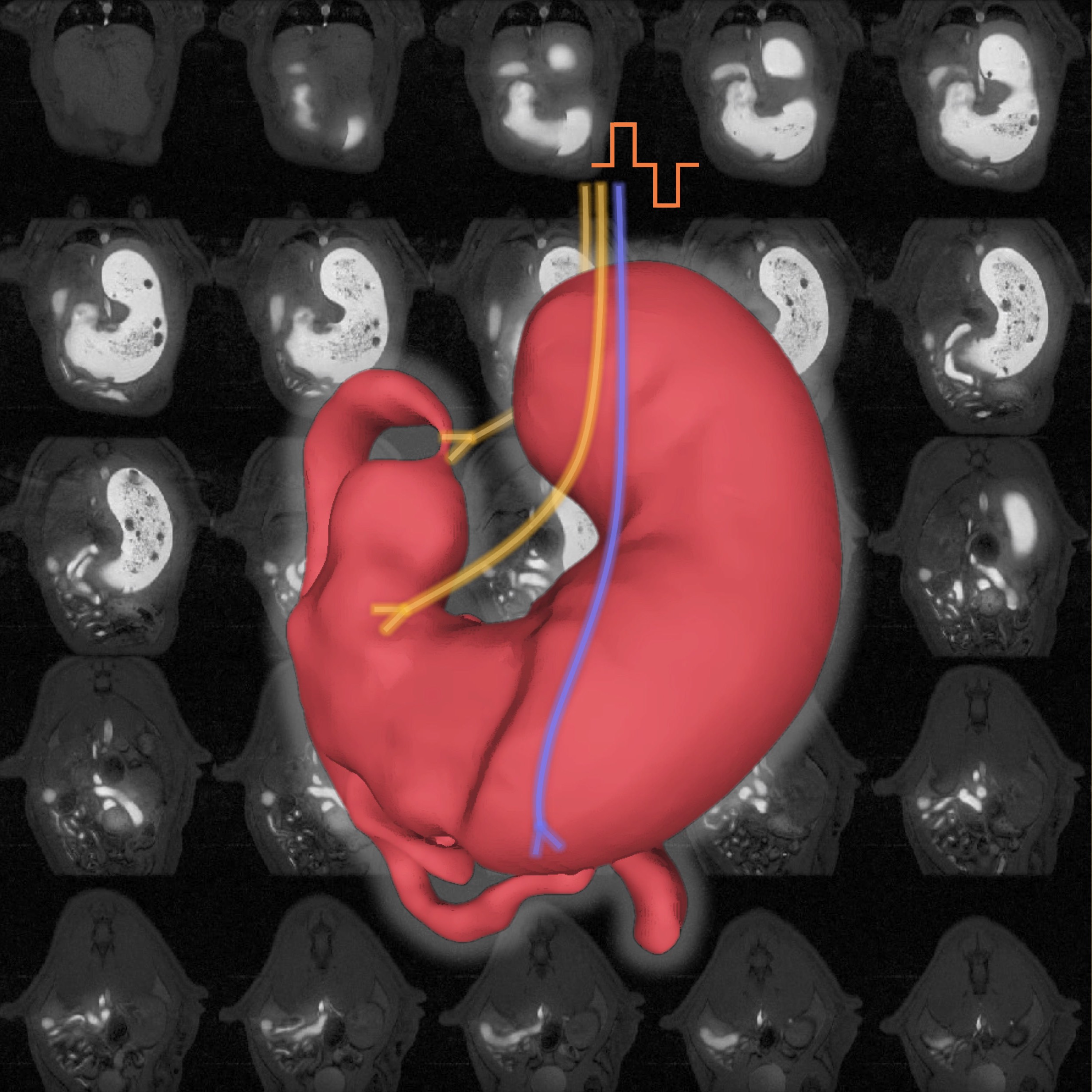 Effects of nodose ganglion blockade on gastric motility during cervical ...