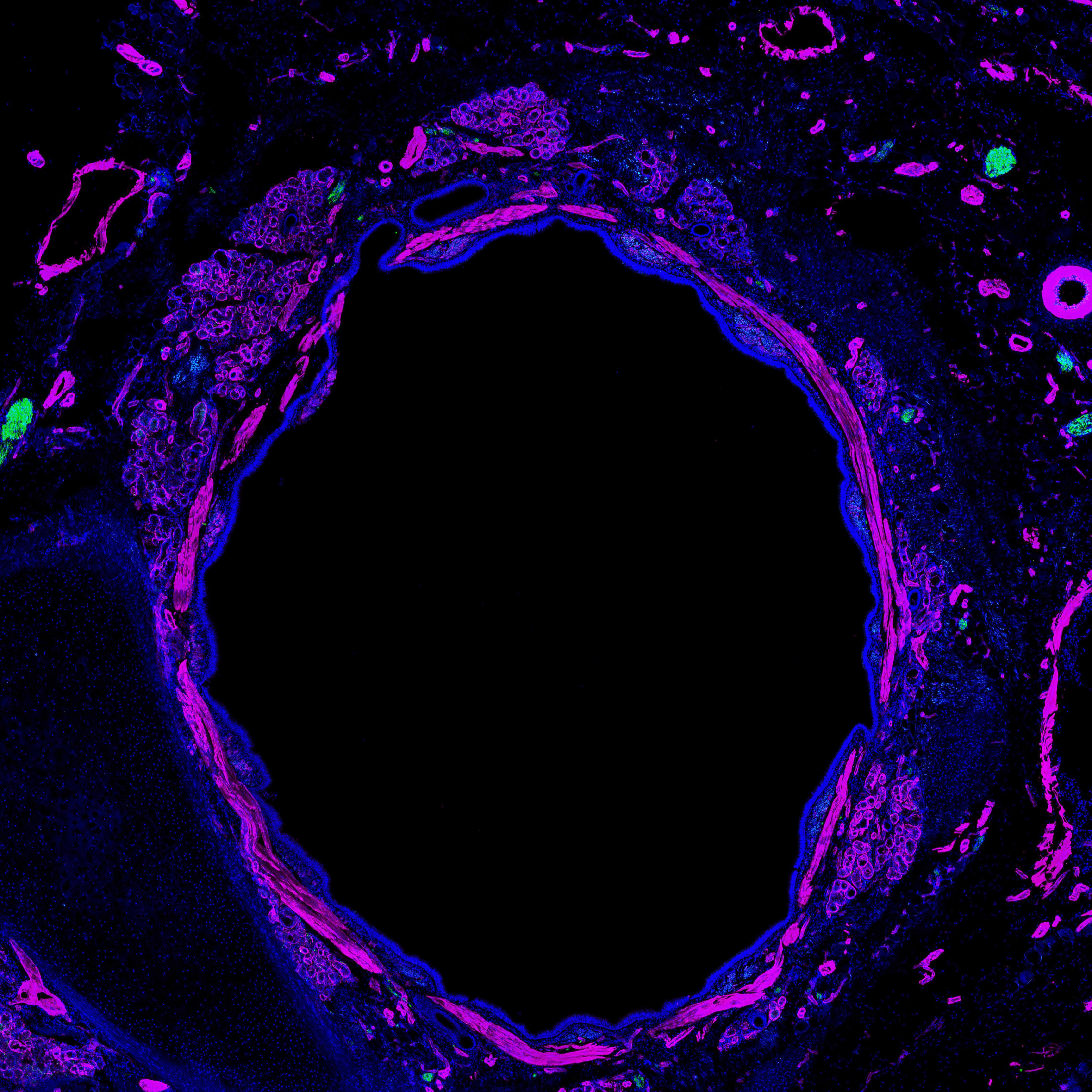 Pennsieve: Immunostaining of human lung sections and mouse vagal ...