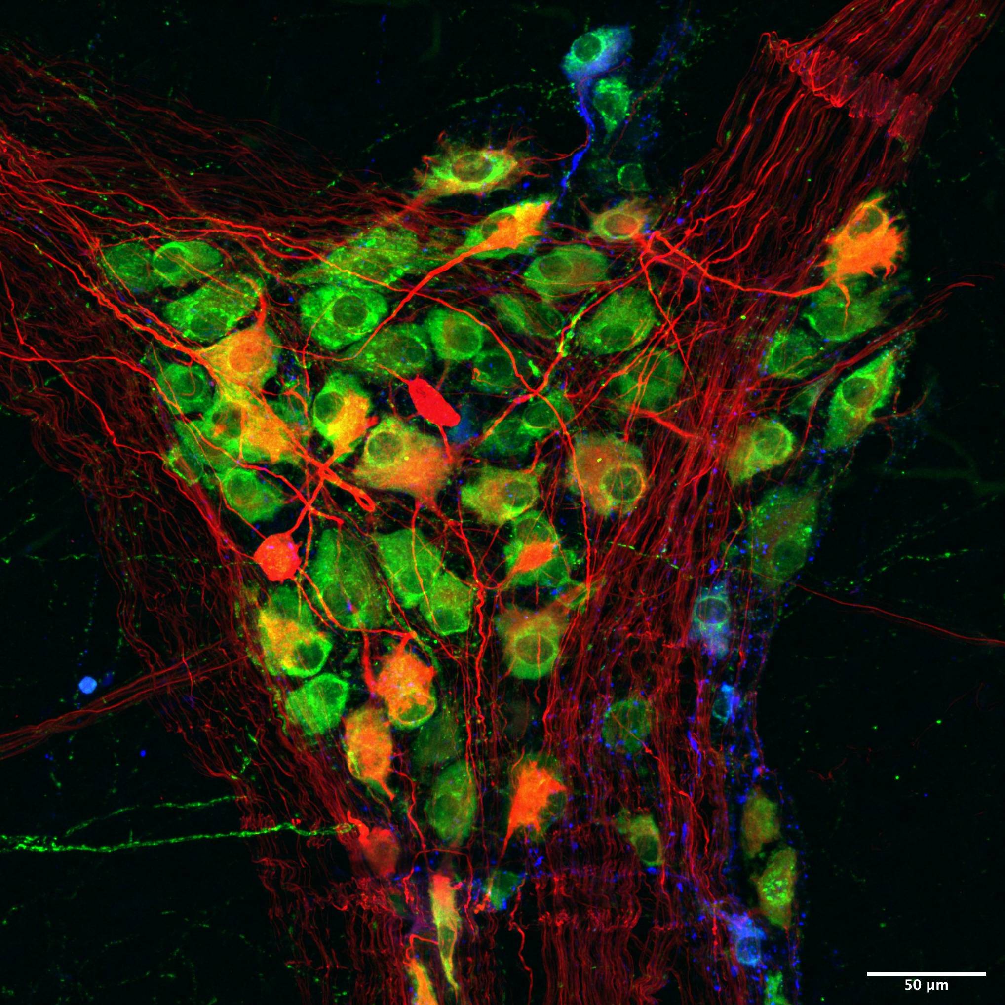 Pennsieve: Immunohistochemical characterisation of myenteric neurons in ...